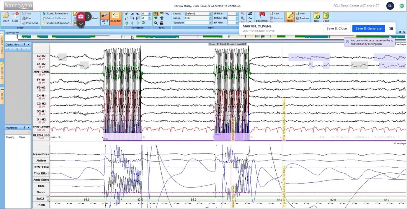 December 15, 2022 Somnoware Release Notes – Somnoware
